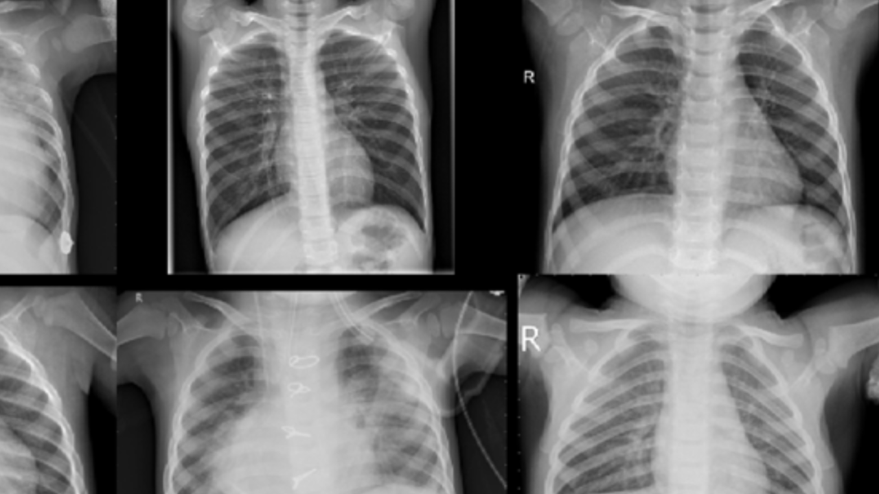 Enhancing Medical Image Analysis with MATLAB: Transforming Diagnostics ...