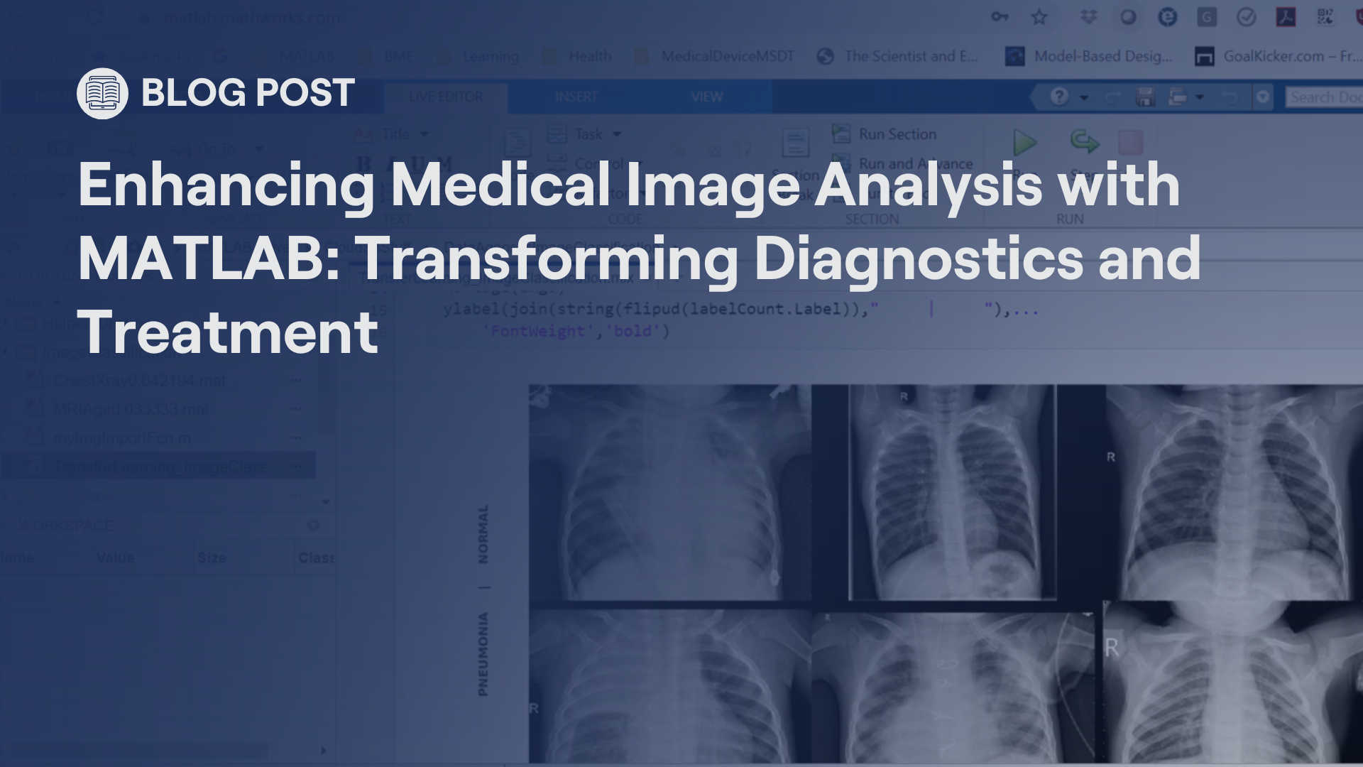 Enhancing Medical Image Analysis with MATLAB: Transforming Diagnostics ...